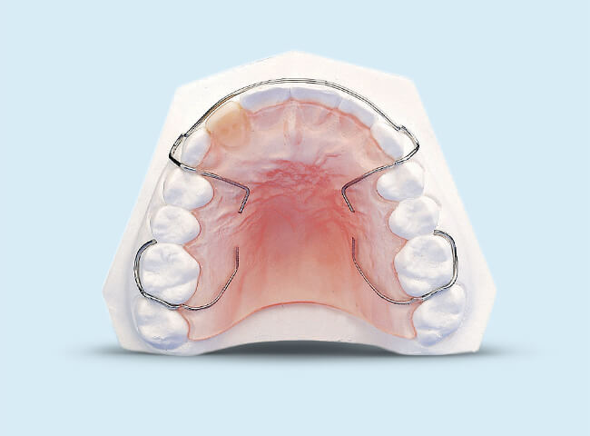 Todo lo que necesitas saber sobre los retenedores dentales - Clínica Ferrús
